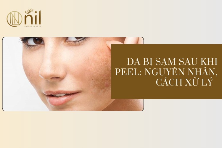 Da Bị Sạm Sau Khi Peel: Nguyên Nhân, Cách Xử Lý - NIL Cosmetic - Mặt Nạ ...